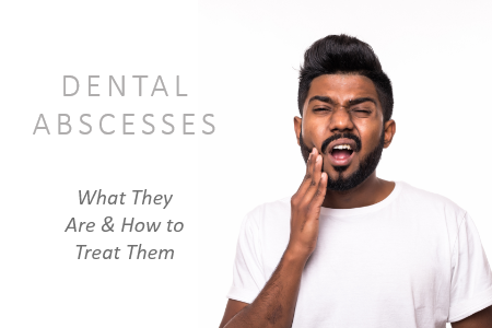 Dental Abscesses: What They Are and How to Treat Them - Caring Tree ...