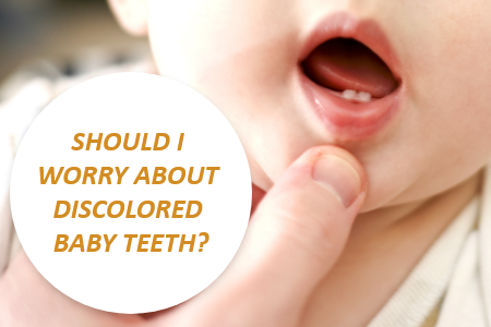 Why Kids Teeth Can Be Discolored | Caring Tree Children's Dentistry ...