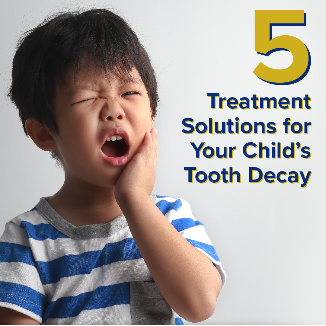 Tooth Decay | Caring Tree Children's Dentistry | Lincoln & Grass Valley, CA