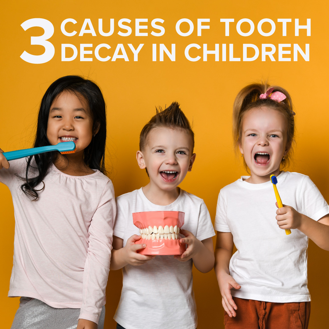 Tooth Decay | Caring Tree Children's Dentistry | Lincoln & Grass Valley, CA